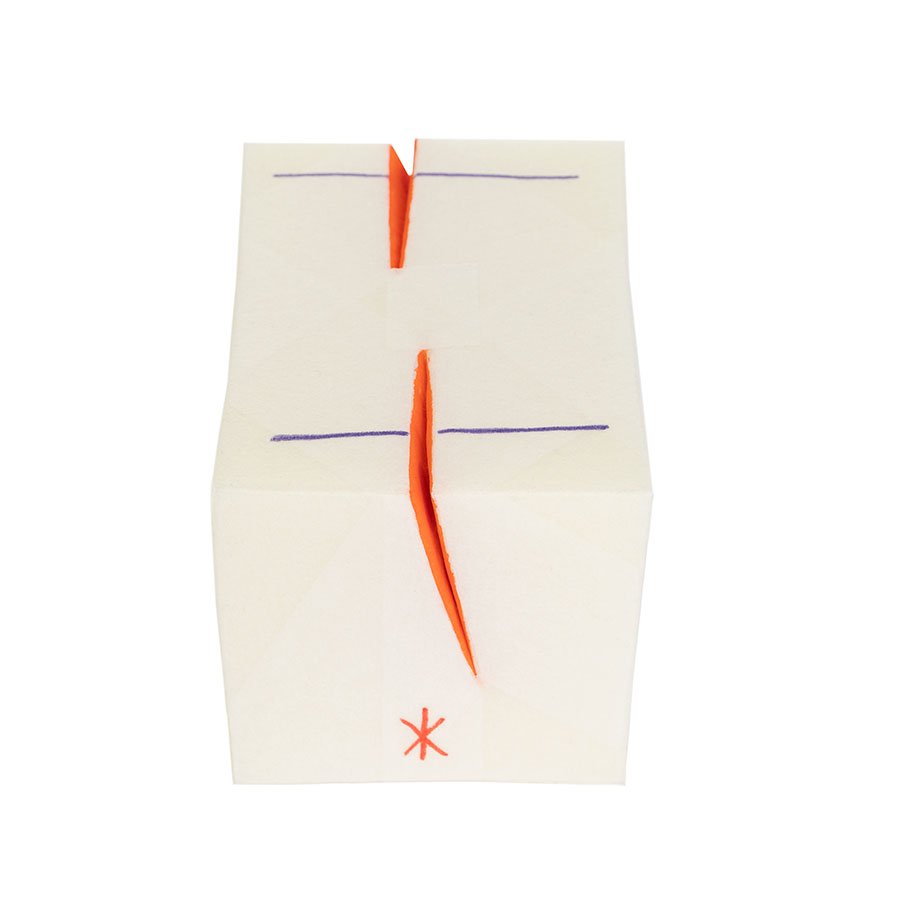 Mediolateral episiotomy repair trainer - patient's left side ...